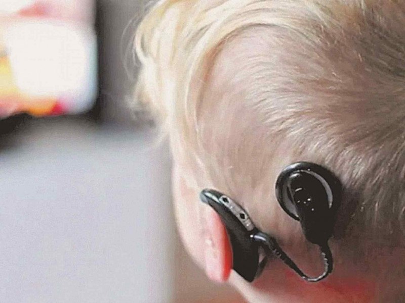 Você conhece o implante coclear?