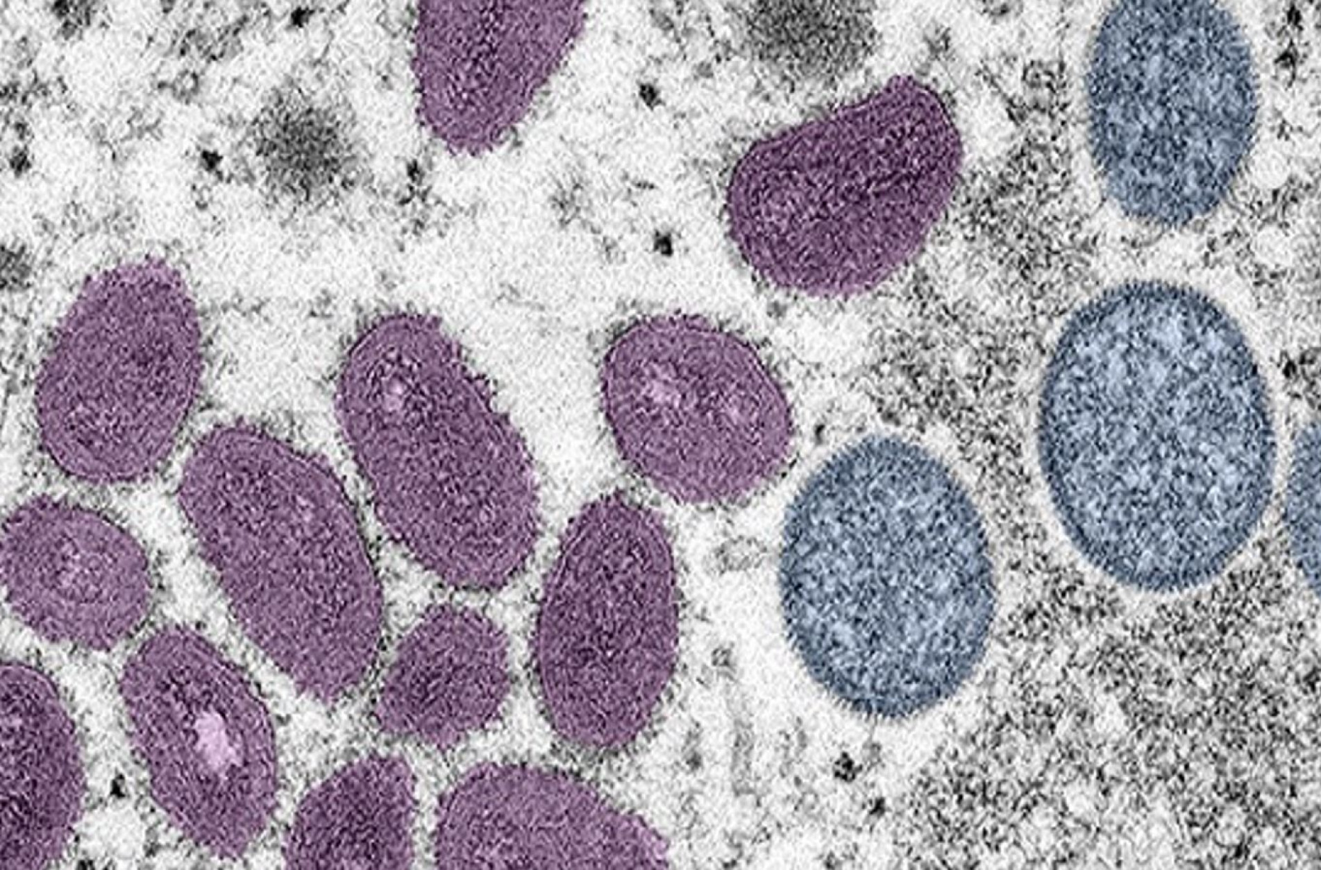 Notificação de casos da varíola dos macacos passa a ser obrigatória